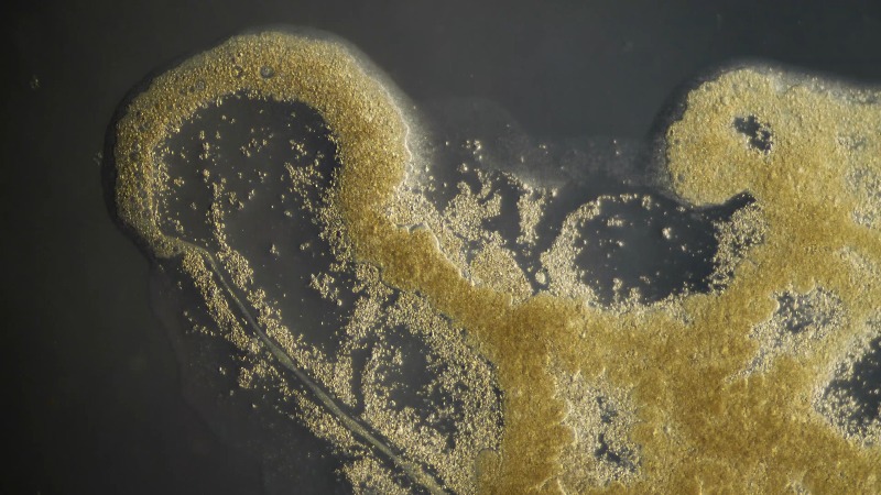 Slime Mold, Physarum Polycephalum, Magnified, Microscopic by Benedikt ...