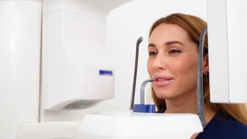 Dental Procedure, Mouth, Cbct Scan, Cone Beam Ct by Artem Medvediev ...